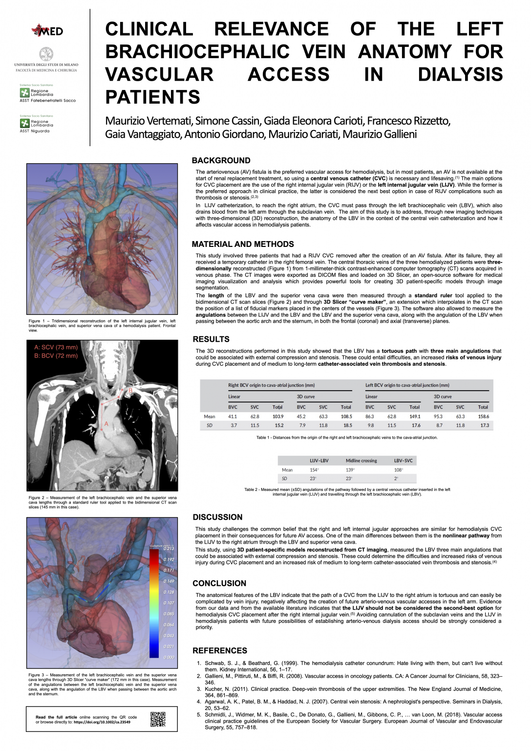 Rilevanza clinica della vena brachiocefalica sinistra come accesso ...